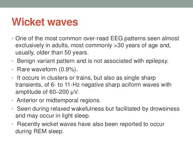 Sleep Activity In Eeg