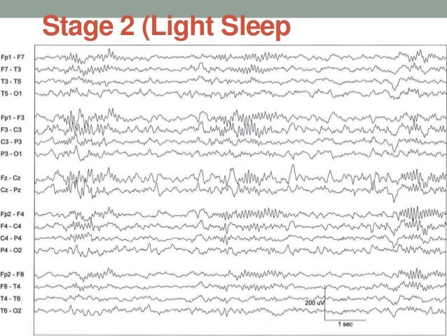 Sleep activity in eeg
