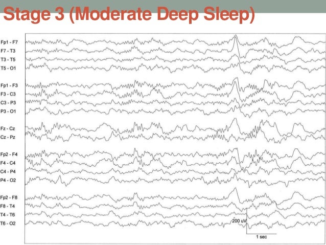 Sleep activity in eeg