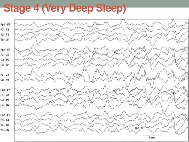 Sleep activity in eeg