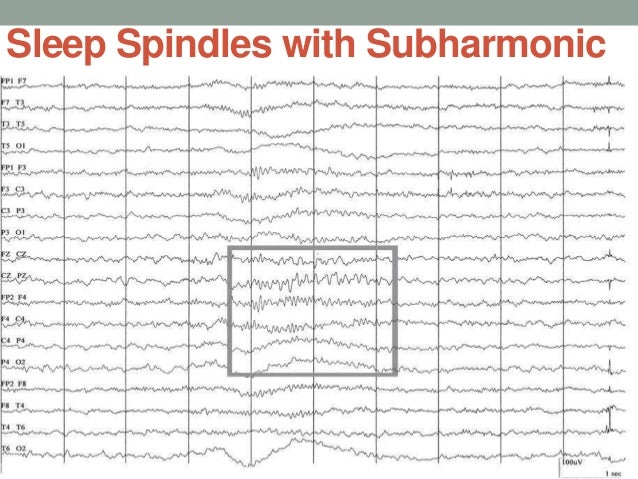 Sleep activity in eeg