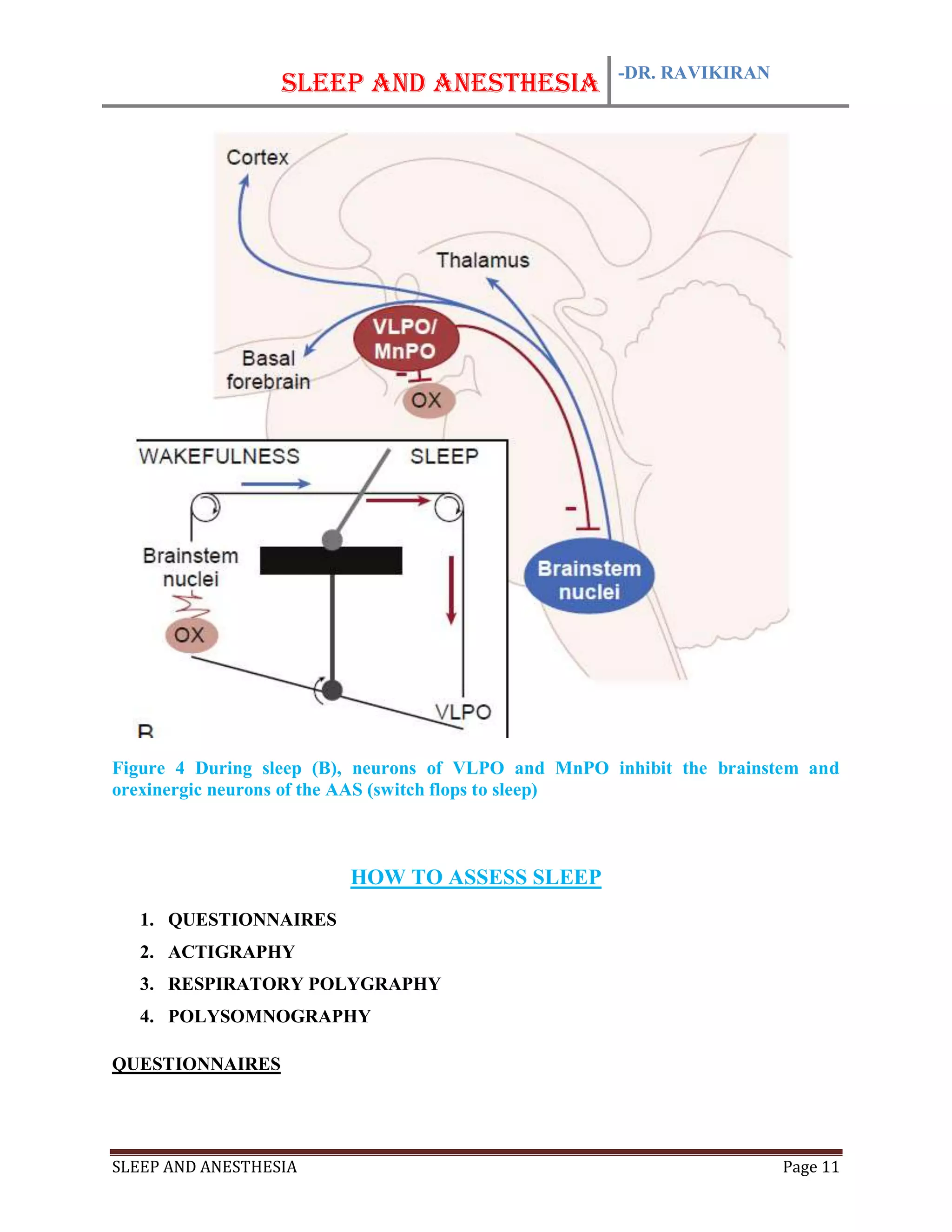 Sleep and anesthesia | PDF