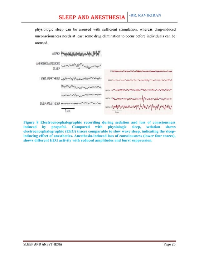 Sleep and anesthesia | PDF