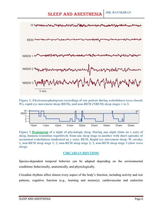 Sleep and anesthesia | PDF