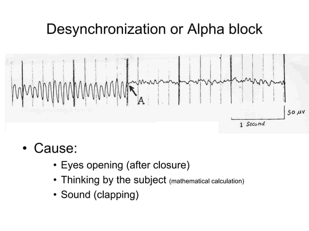 Sleep physiology and EEG waves in humans PPT | PPTX