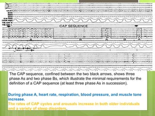 Sleep and its disorders | PPTX