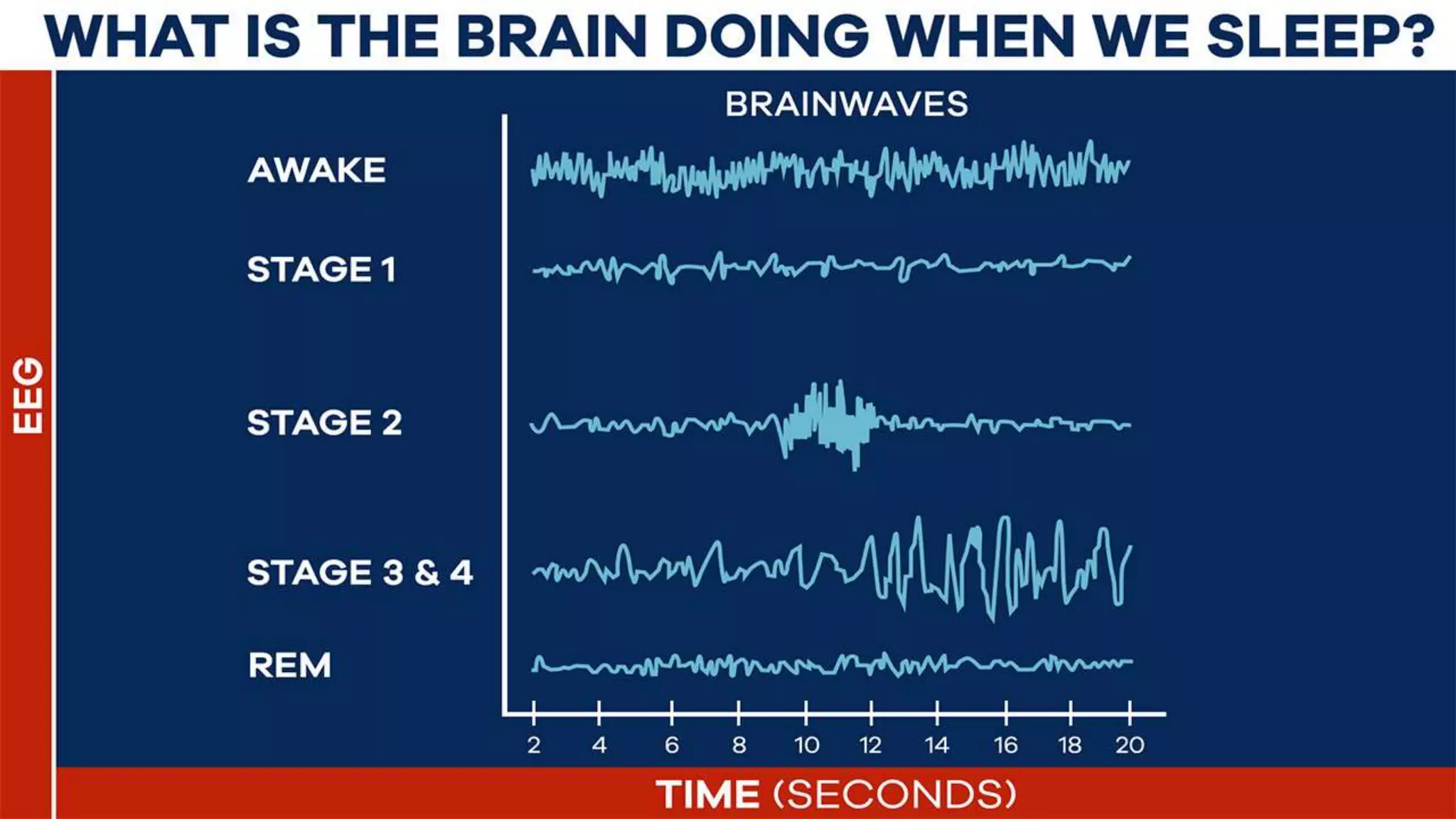 Sleep and sensory balances (overload and deprivation.pptx