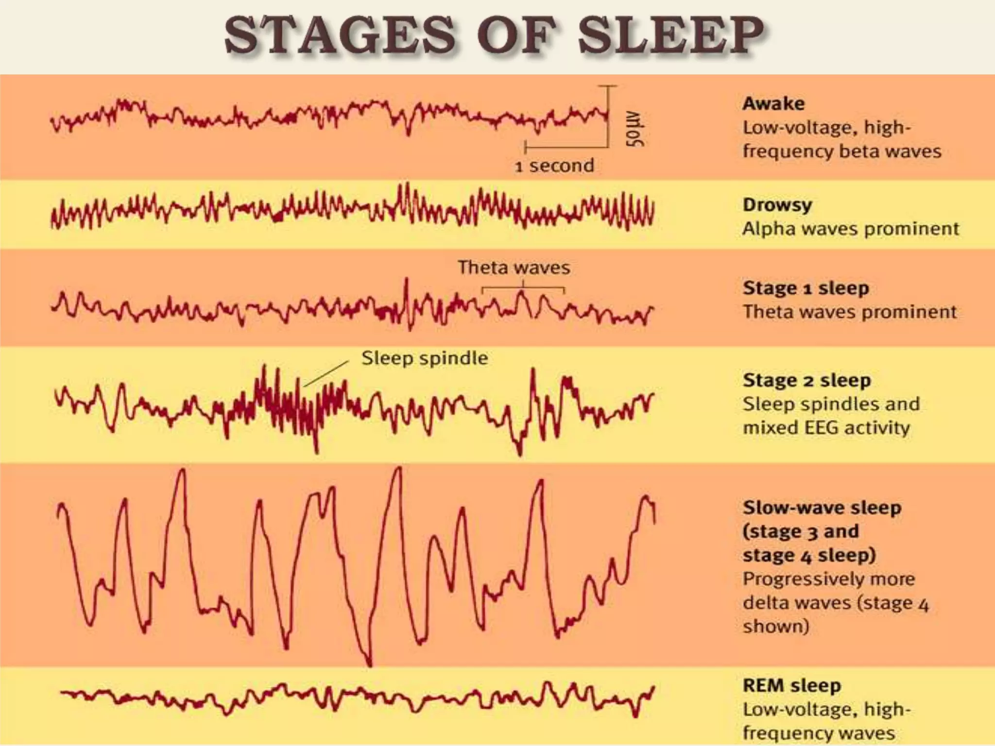 Sleep and sleep disorder | PPSX | Sleep Disorders | Diseases and Conditions