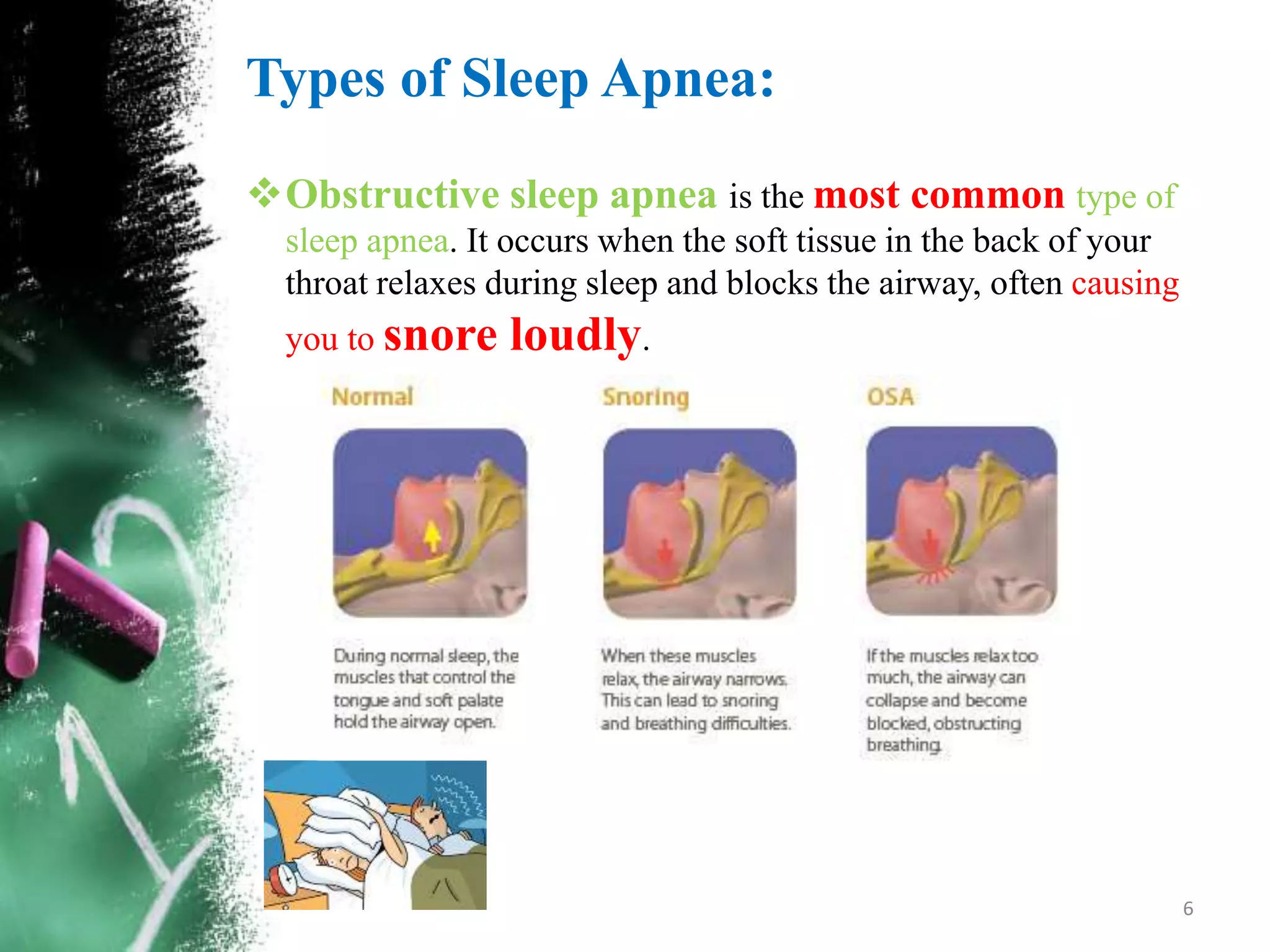 Sleep apnea in dentistry and Orthodontics | PPTX