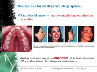 Sleep apnea in dentistry and Orthodontics | PPTX