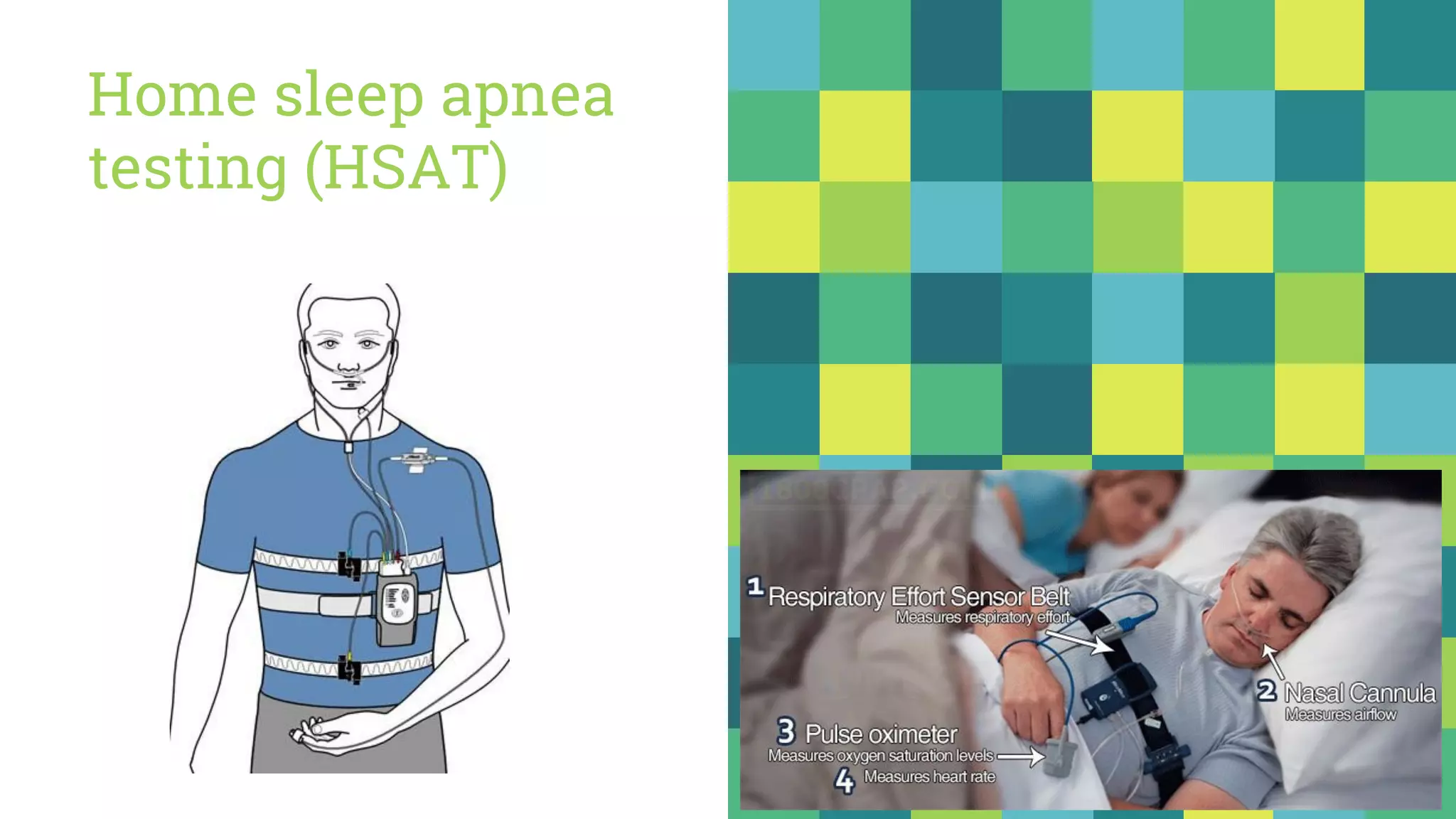 Sleep apnea | PDF
