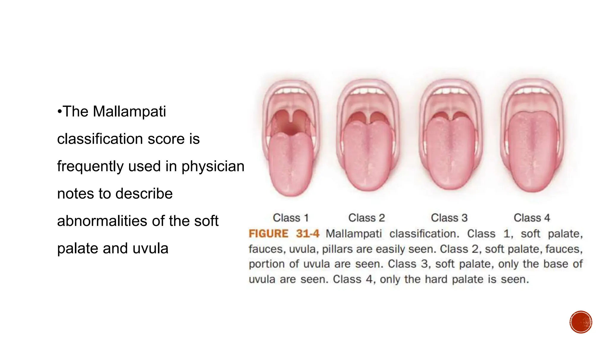 Types of sleep apnea and its management.pptx