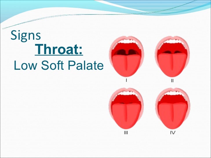 Sleep apnea & its treatment