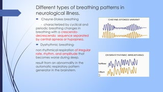 SLEEP APNEA SYNDROME by Dr. Anuhya krishna | PPTX