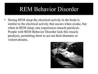 Sleep disorders | PPTX