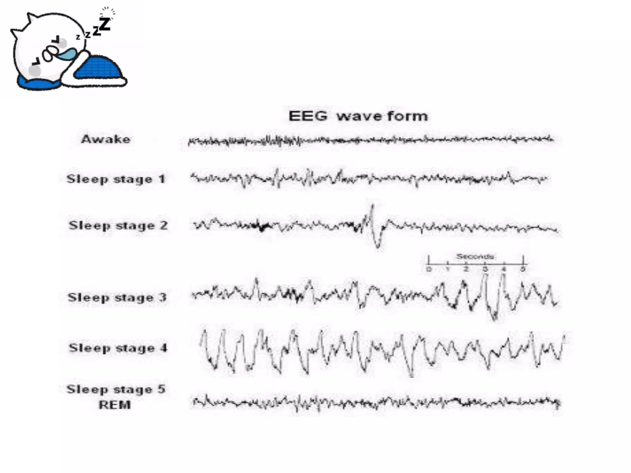 Physiology of Sleep | PDF