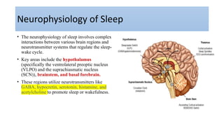 Sleep disorders in children; approach and management | PPTX