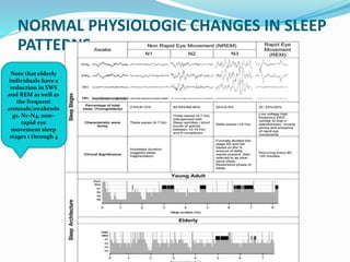 Sleep disorders in elderly | PPTX