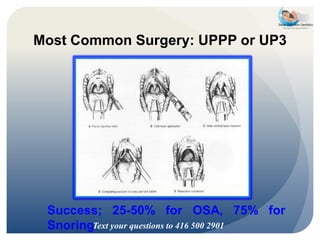 Sleep disorders risk management | PPTX