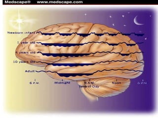 Sleep Disruption | PPT