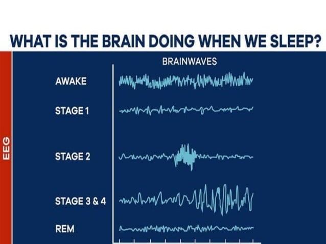 Sleep Disturbance in ICU critical c.pptx