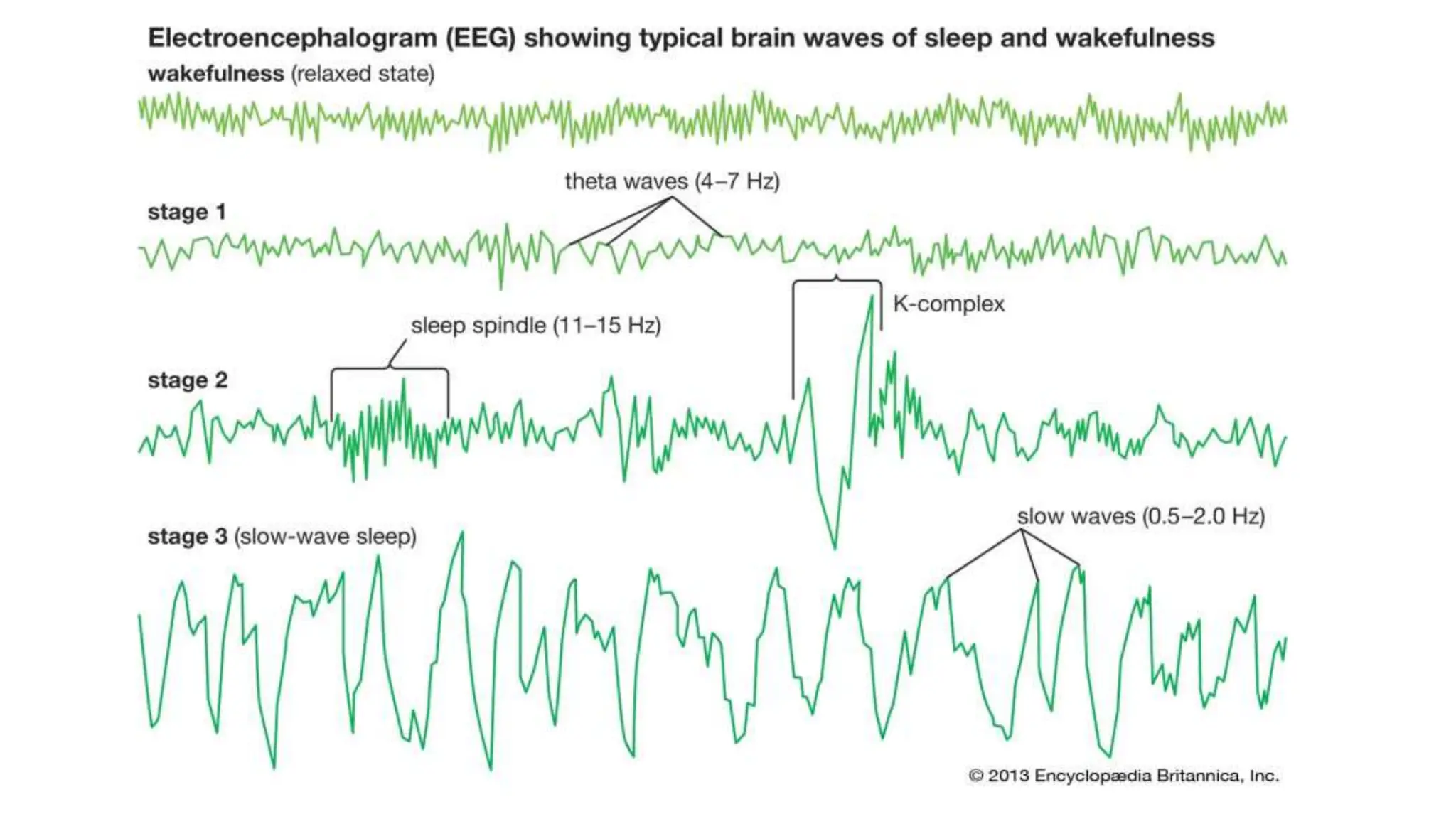 Sleep EEG_Akash Kalita project proposal.pptx