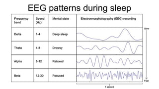 Sleep EEG_Akash Kalita project proposal.pptx