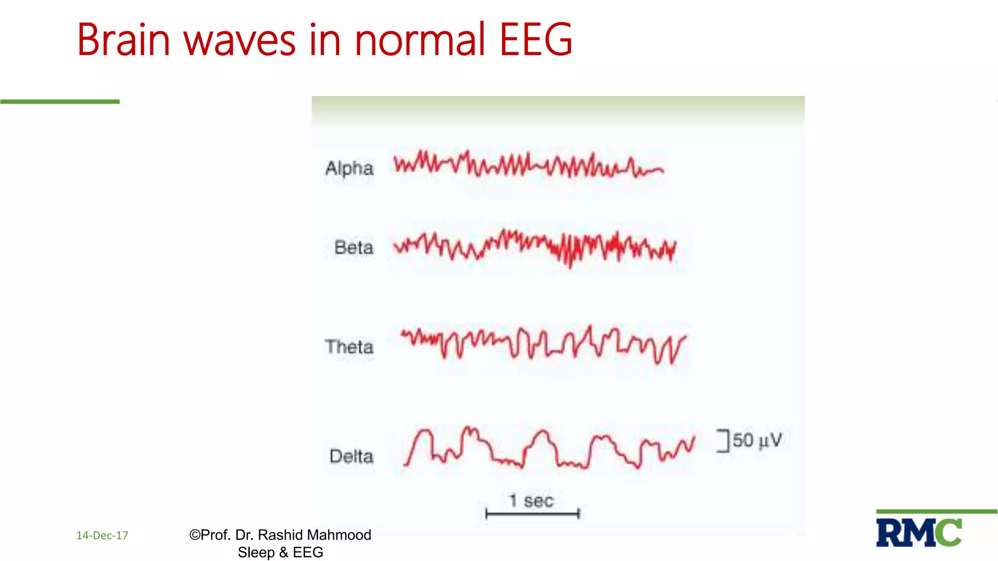Sleep Physiology & EEG (Electroencephalogram) | PPTX