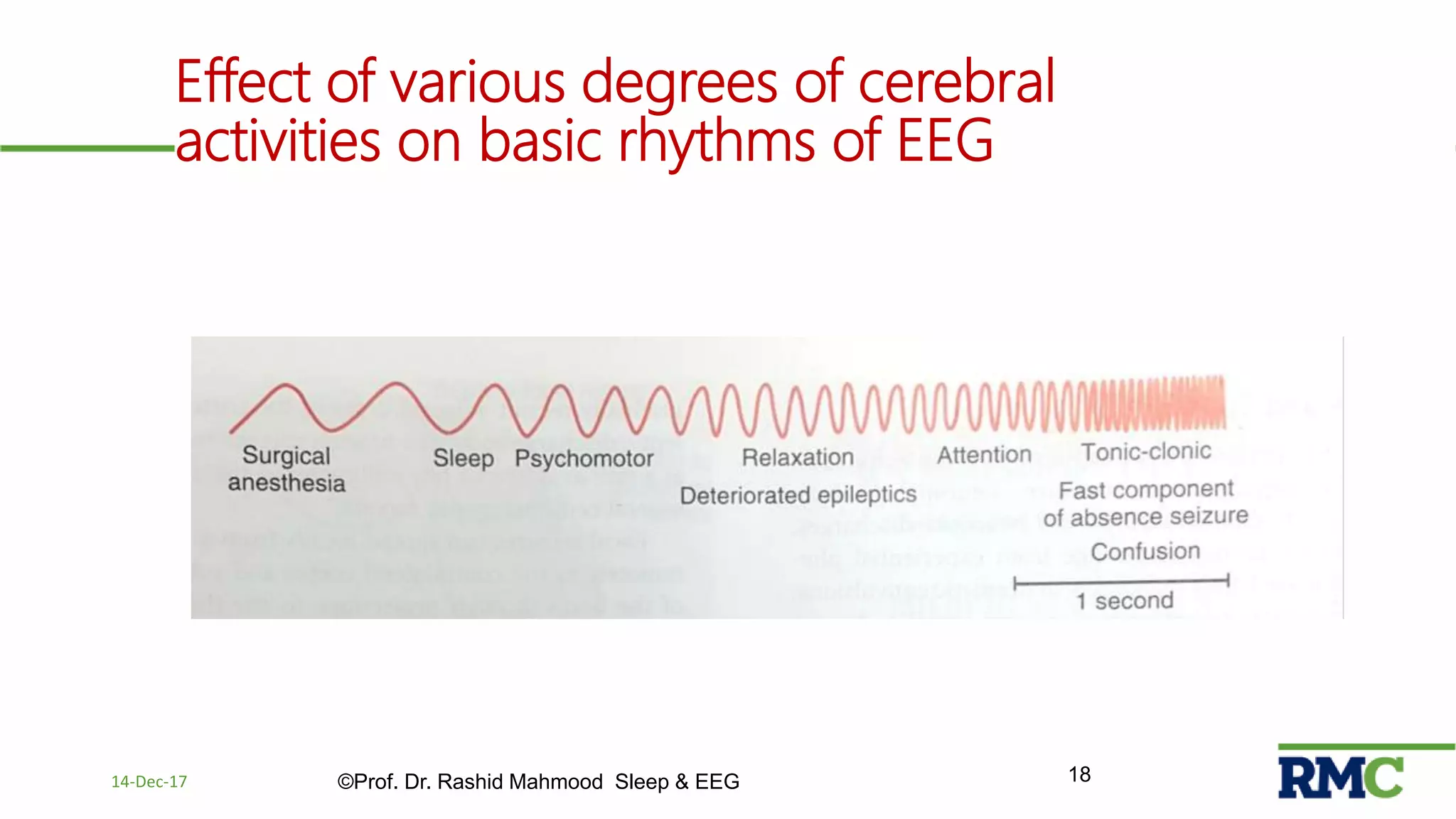 Sleep Physiology & EEG (Electroencephalogram) | PPTX