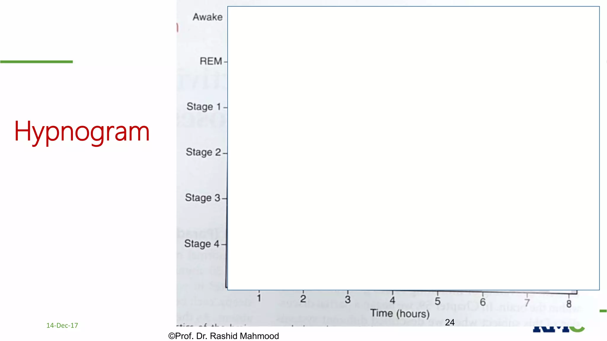 Sleep Physiology & EEG (Electroencephalogram) | PPTX