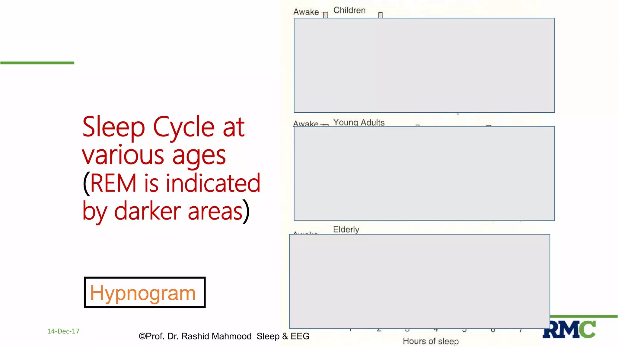Sleep Physiology & EEG (Electroencephalogram) | PPTX