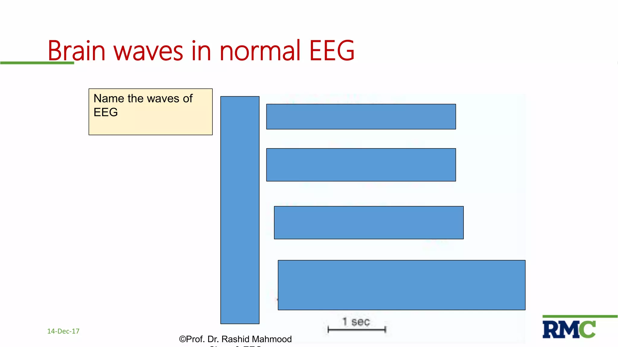 Sleep Physiology & EEG (Electroencephalogram) | PPTX