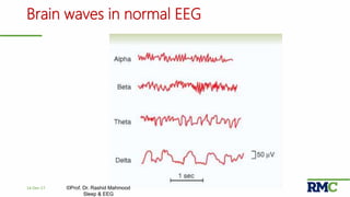 Sleep Physiology & EEG (Electroencephalogram) | PPTX