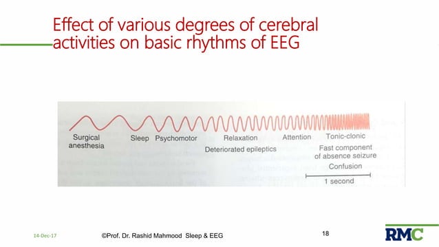 Sleep Physiology & EEG (Electroencephalogram) | PPTX | Brain and ...
