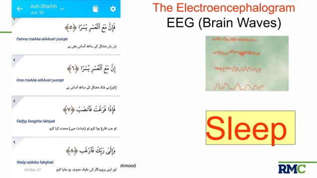 Sleep Physiology & EEG (Electroencephalogram) | PPTX | Brain and Nervous System Disorders ...