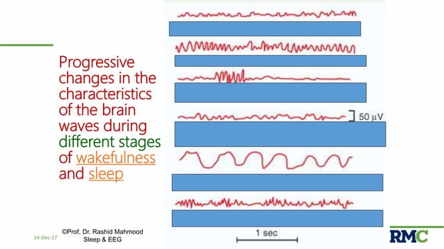 Sleep Physiology & EEG (Electroencephalogram) | PPTX | Brain and ...