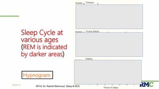 Sleep Physiology & EEG (Electroencephalogram) | PPTX