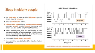 Sleep in elderly people from theory to practice.ppsx