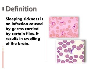 Sleeping sickness[1] | PPTX | Infectious Diseases | Diseases and Conditions