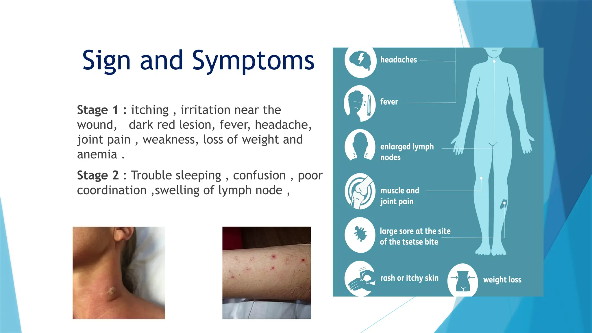 Sleeping sickness by RaghuvanshiS.K..pptx