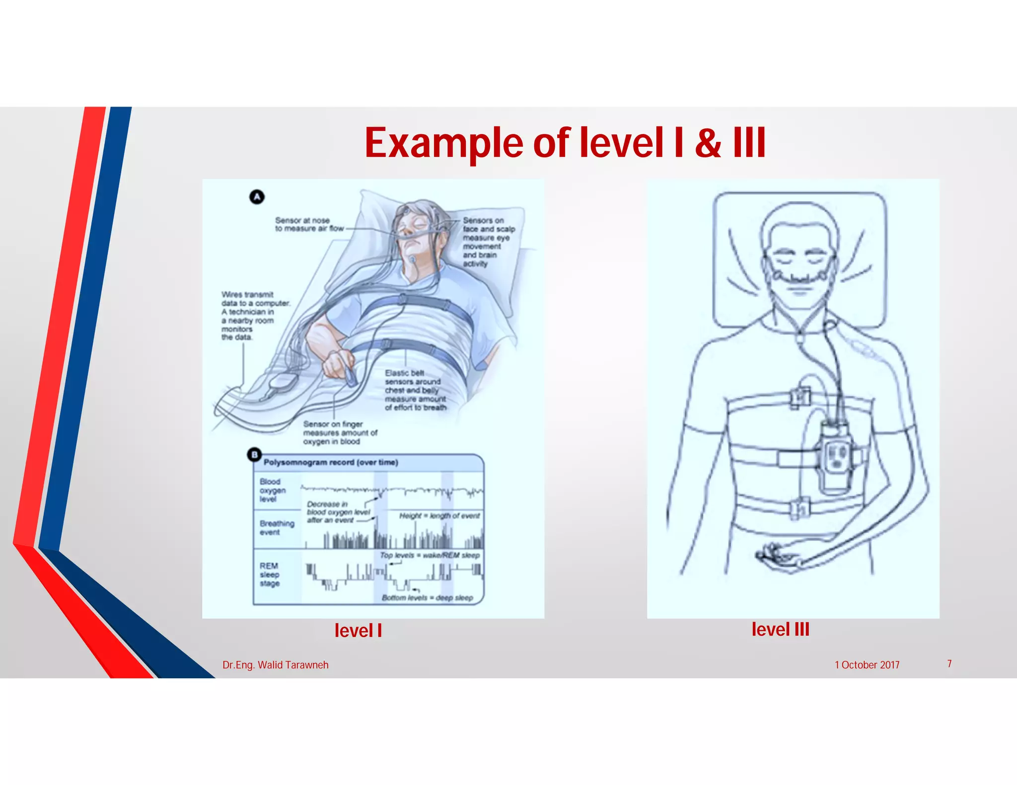 Sleep Laboratory | PDF