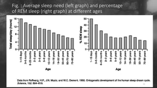 Sleep paralysis | PPTX