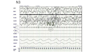 Sleep physiology.pptx by sms medical college jaipur | PPT