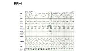 Sleep physiology.pptx by sms medical college jaipur | PPT