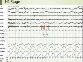 SLEEP PHYSIOLOGY .pptx