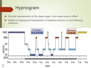 SLEEP PHYSIOLOGY .pptx