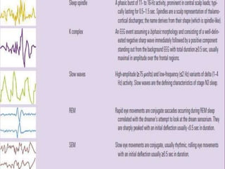 SLEEP PHYSIOLOGY .pptx