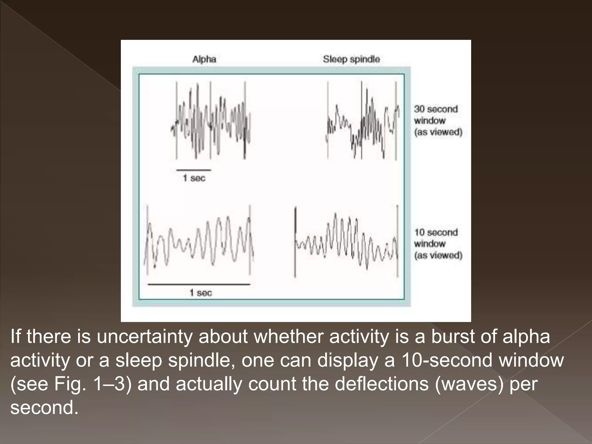 Sleep Scoring New.pptx