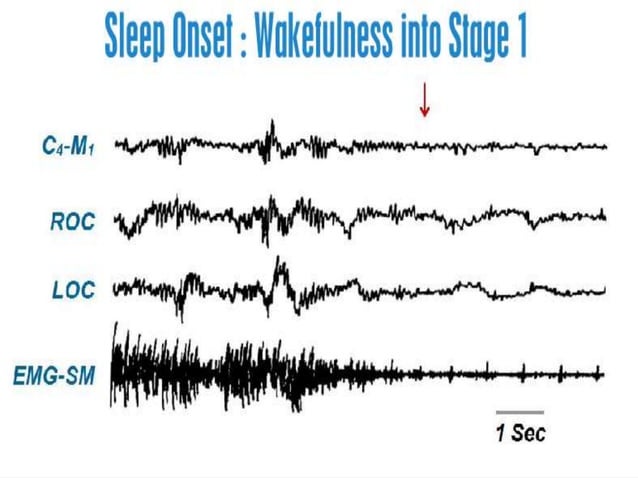 Sleep Scoring New.pptx