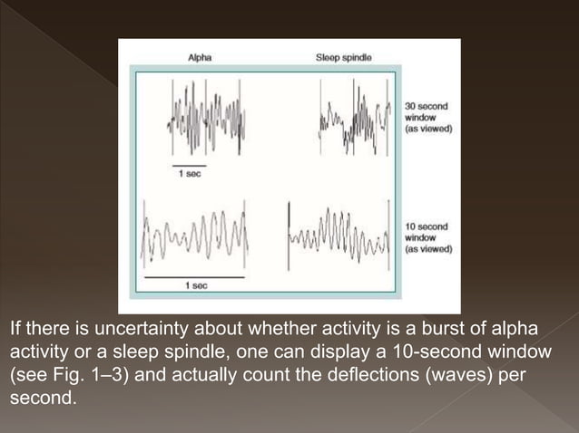 Sleep Scoring New.pptx